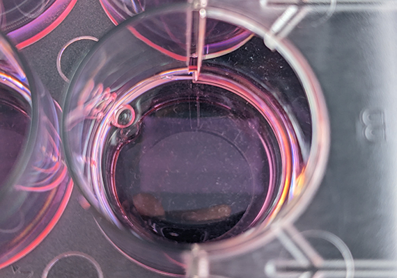 From frog brains to silk bladders: Thirty years apart, two women ...
